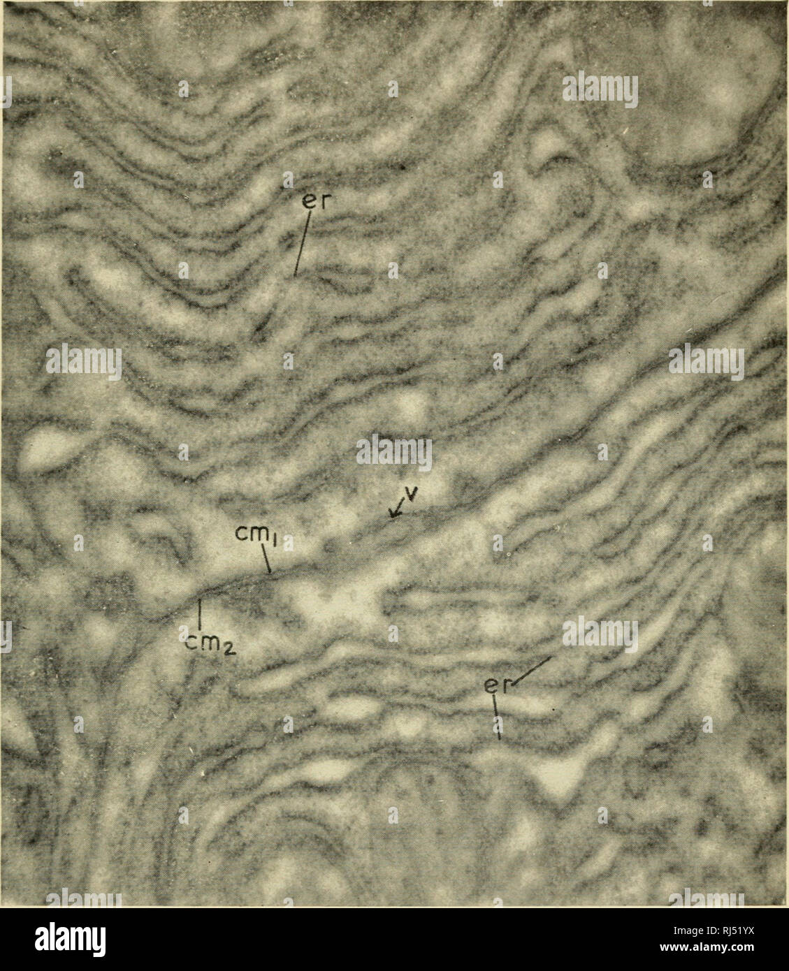 Pancreas acinar cell hi-res stock photography and images - Alamy
