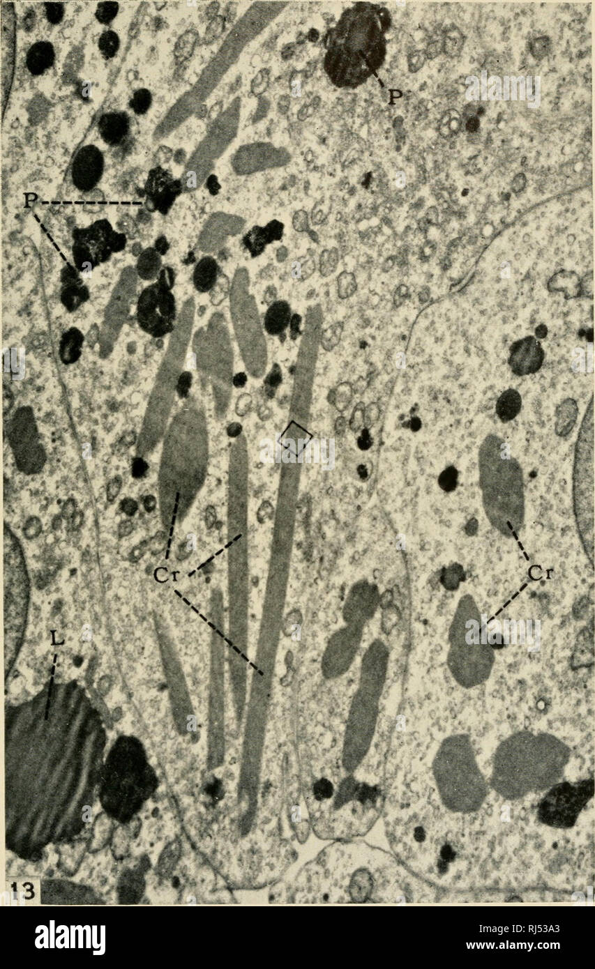 Leydig cells hi-res stock photography and images - Alamy