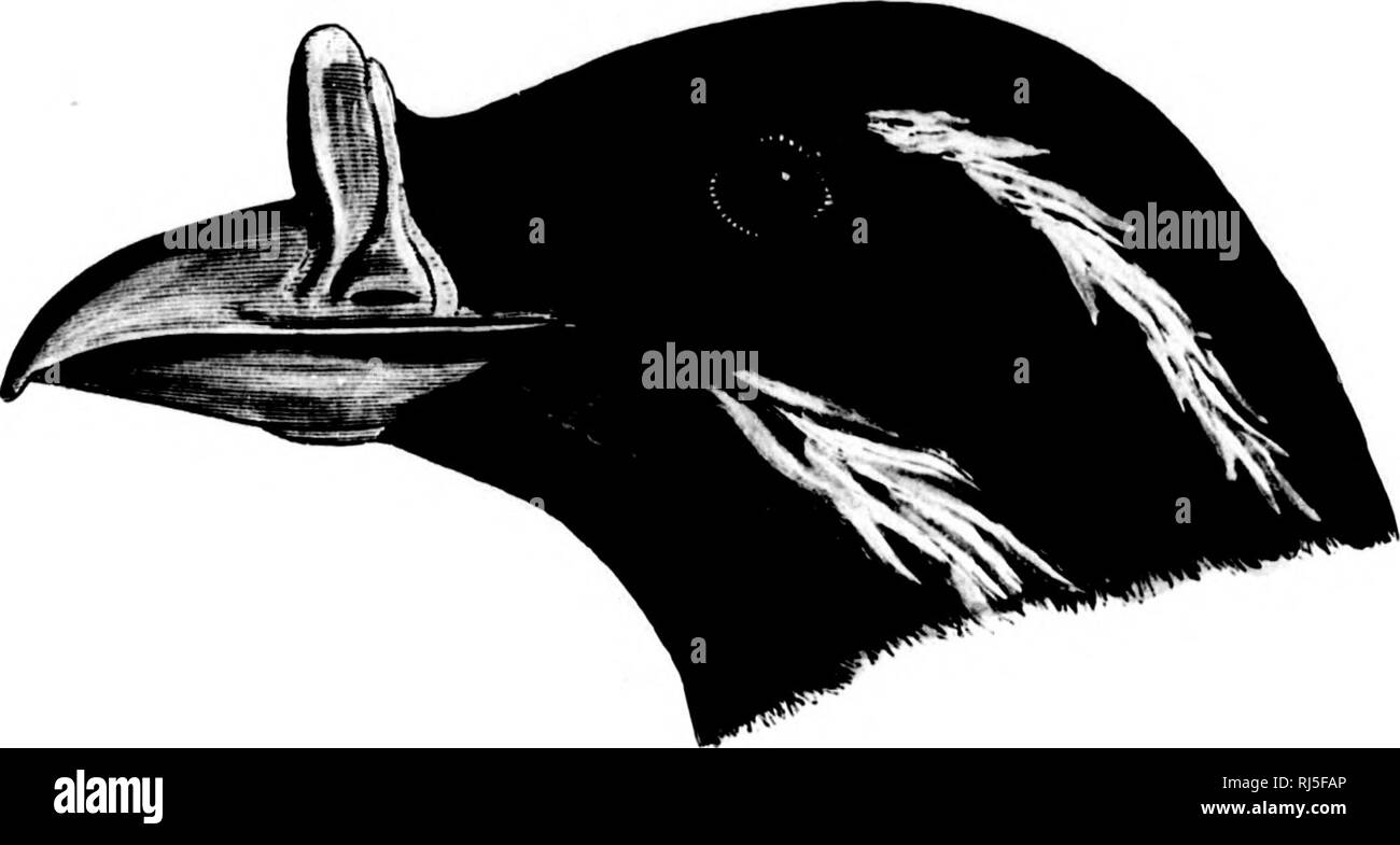 Occiput anterior Black and White Stock Photos & Images - Alamy