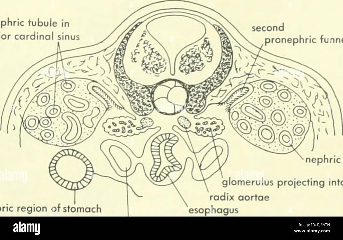 pyloric sinus
