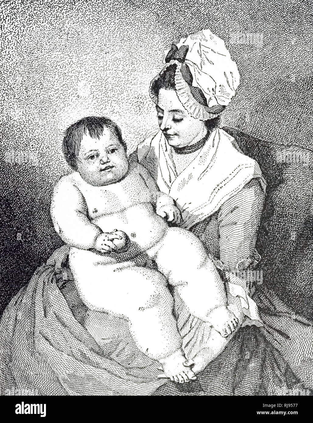 An engraving depicting a child born to a Mrs Everett at Enfield Paper ...