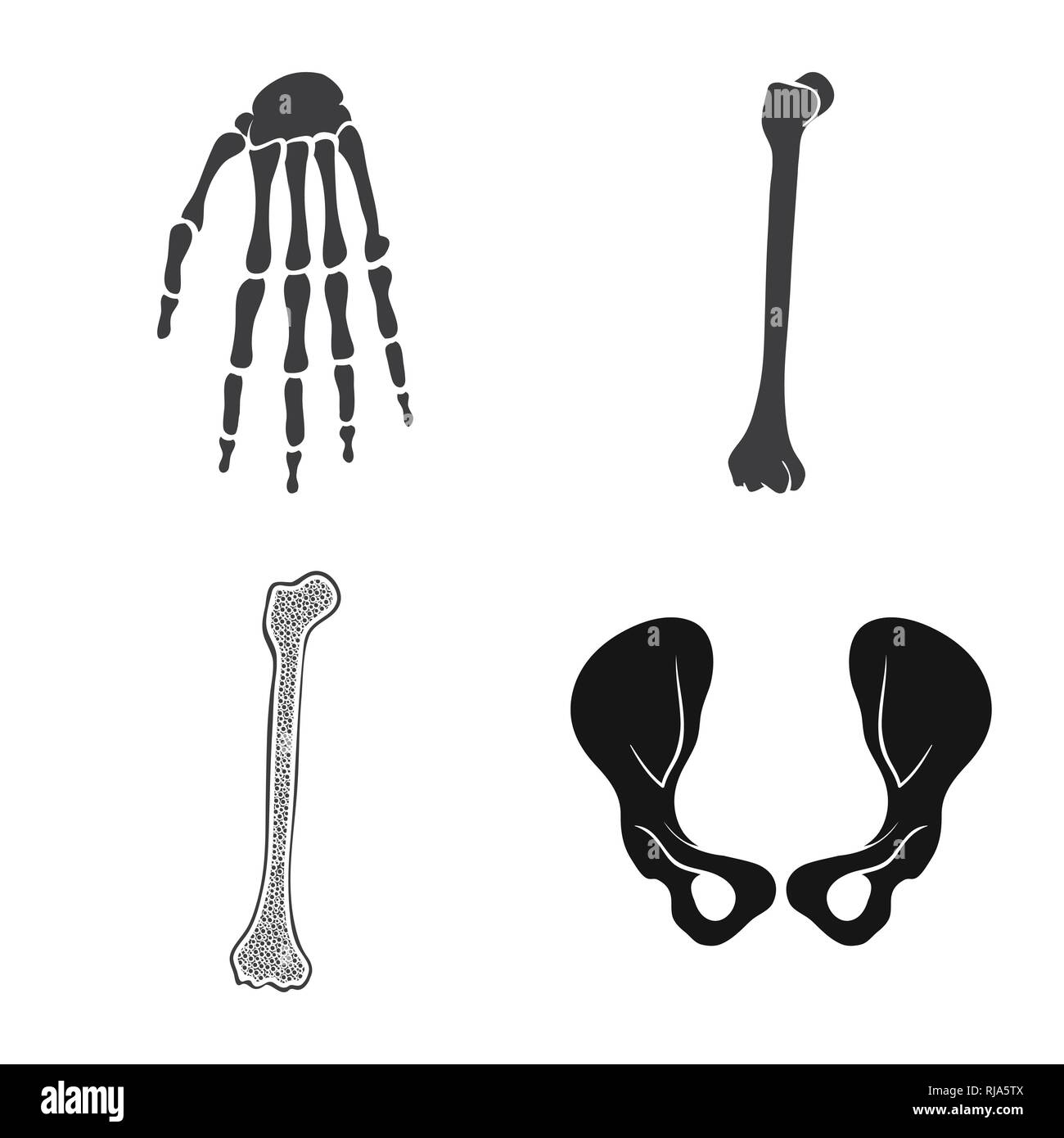 Simple fracture xray hi-res stock photography and images - Alamy