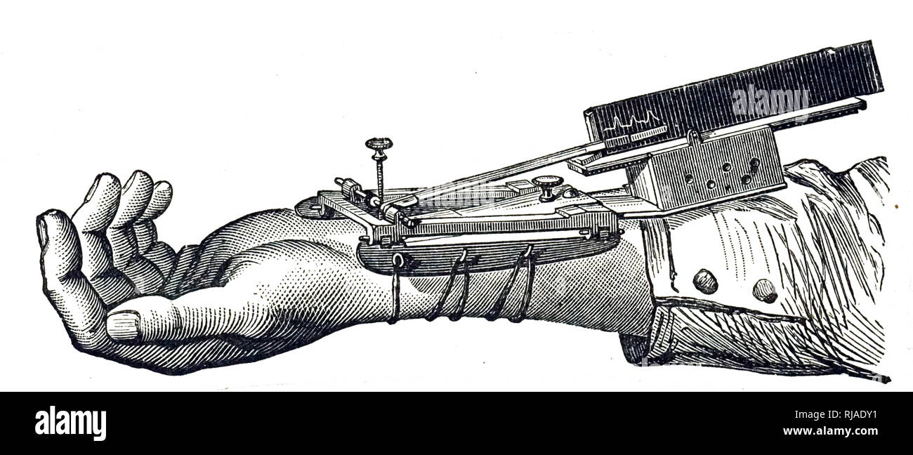 An engraving depicting a sphygmograph, a device invented by Étienne ...