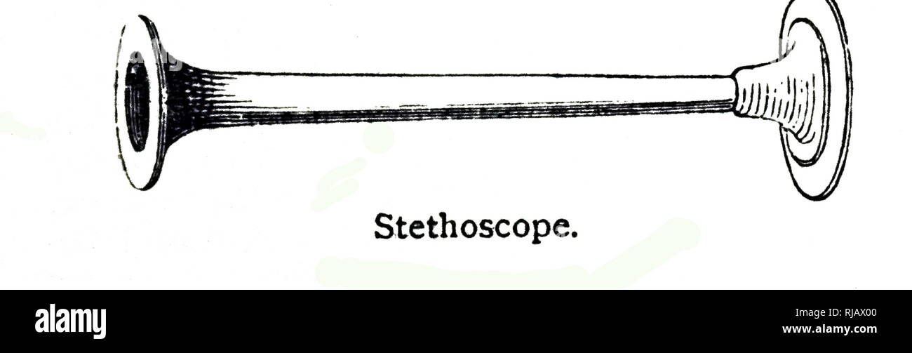 An engraving depicting an early stethoscope, an acoustic medical device ...
