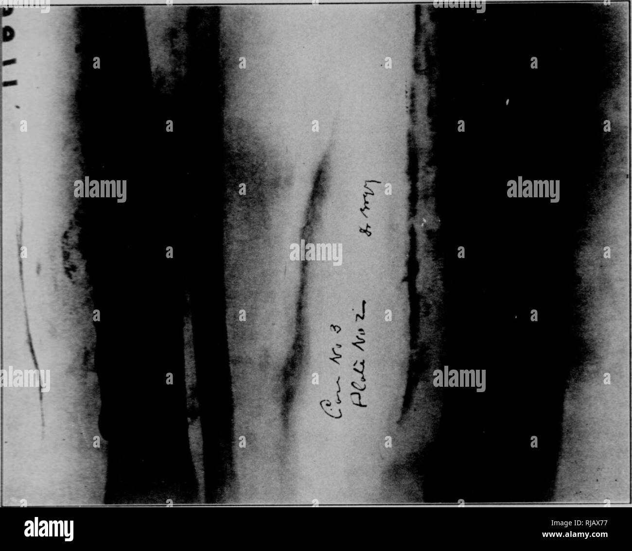 Callus formation hi-res stock photography and images - Alamy