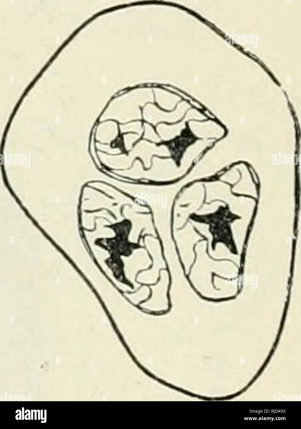 Hyperchromatic cell nuclei hi-res stock photography and images - Alamy
