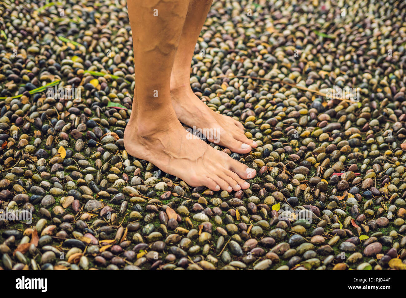 Man Walking On A Textured Cobble Pavement, Reflexology. Pebble stones ...