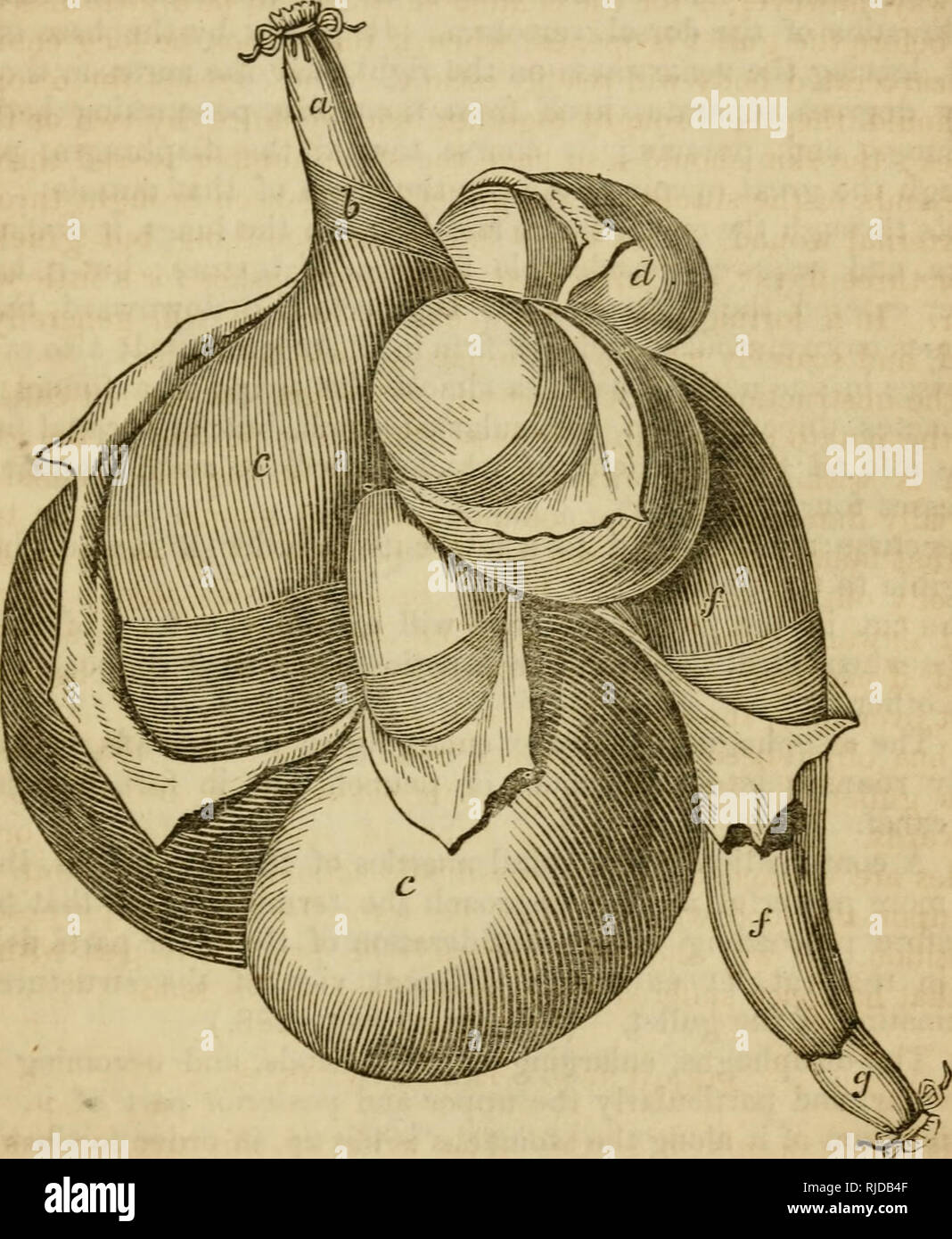 Oesophagus rupture hi-res stock photography and images - Alamy