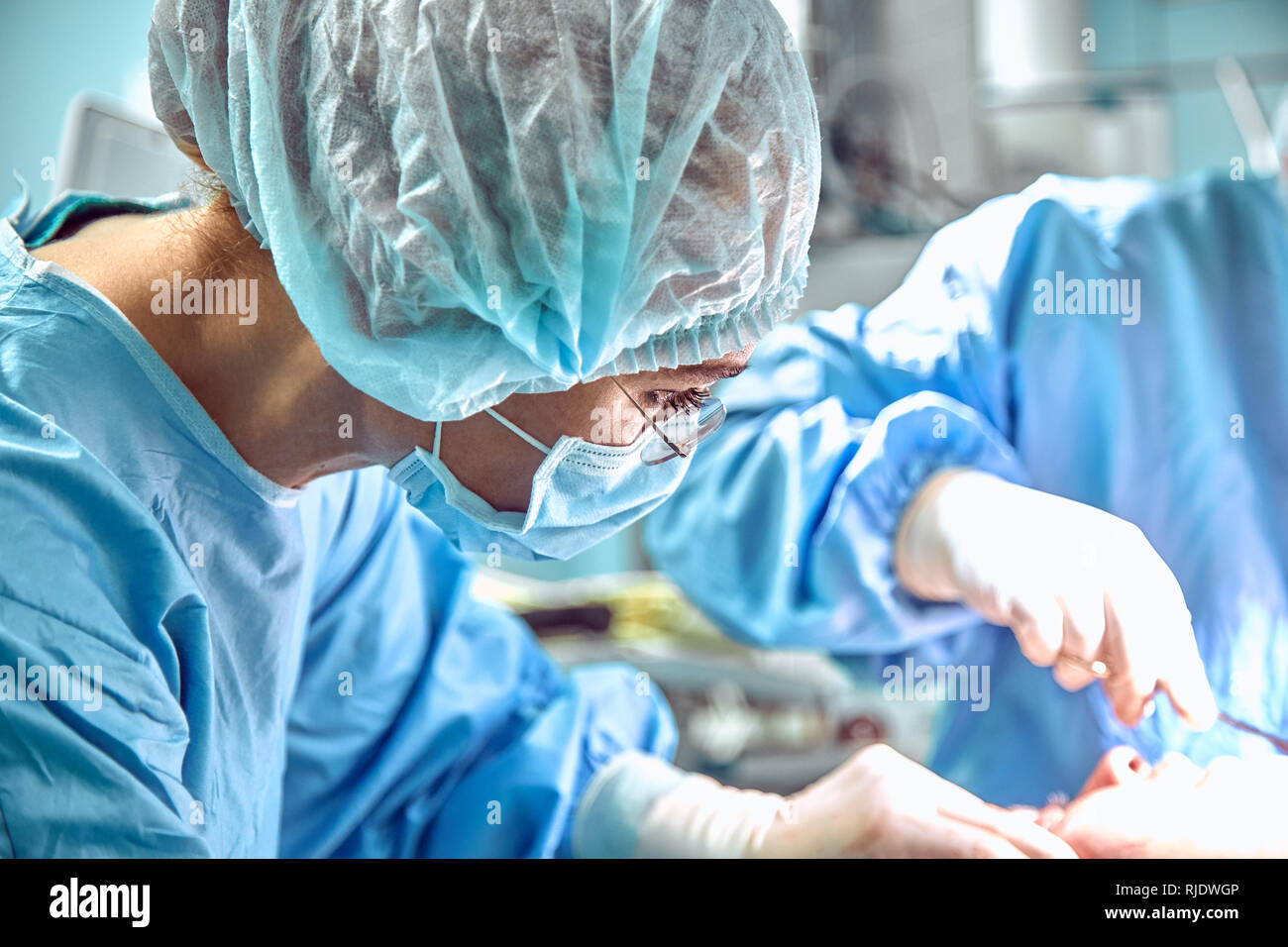 Chin reduction augmentation double chin removal plastic surgery ...