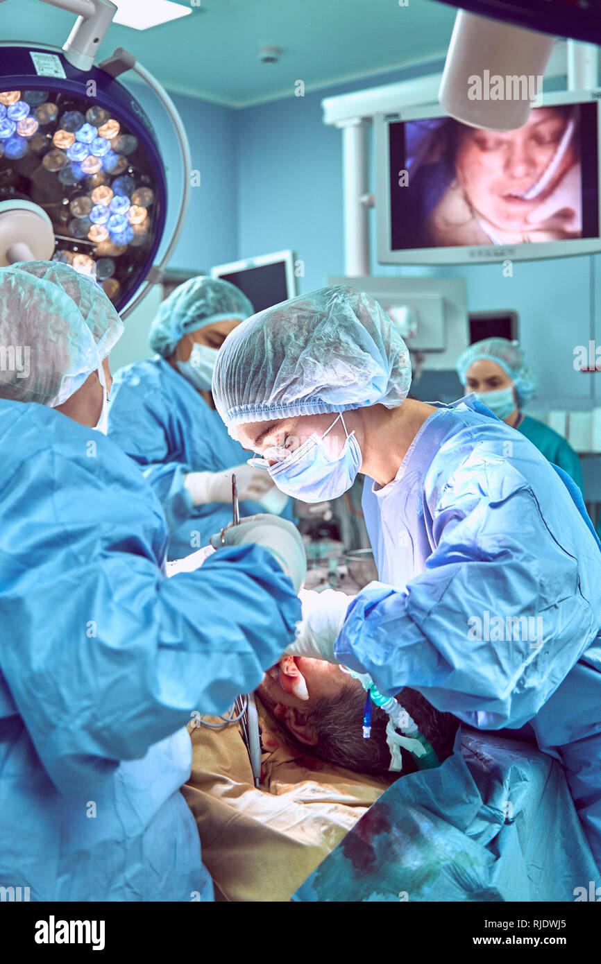 Chin reduction augmentation double chin removal plastic surgery ...