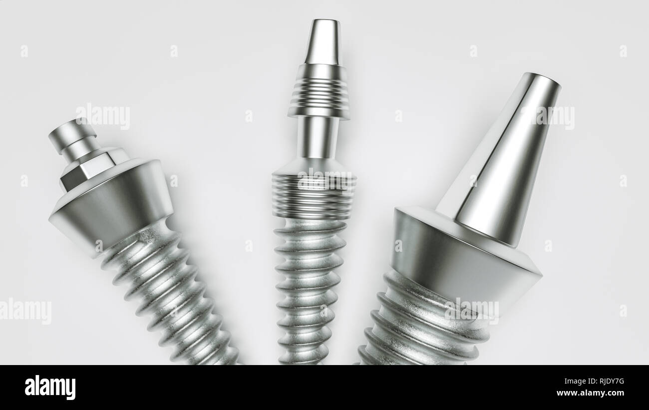 Three different tooth implants -- 3D Rendering Stock Photo - Alamy