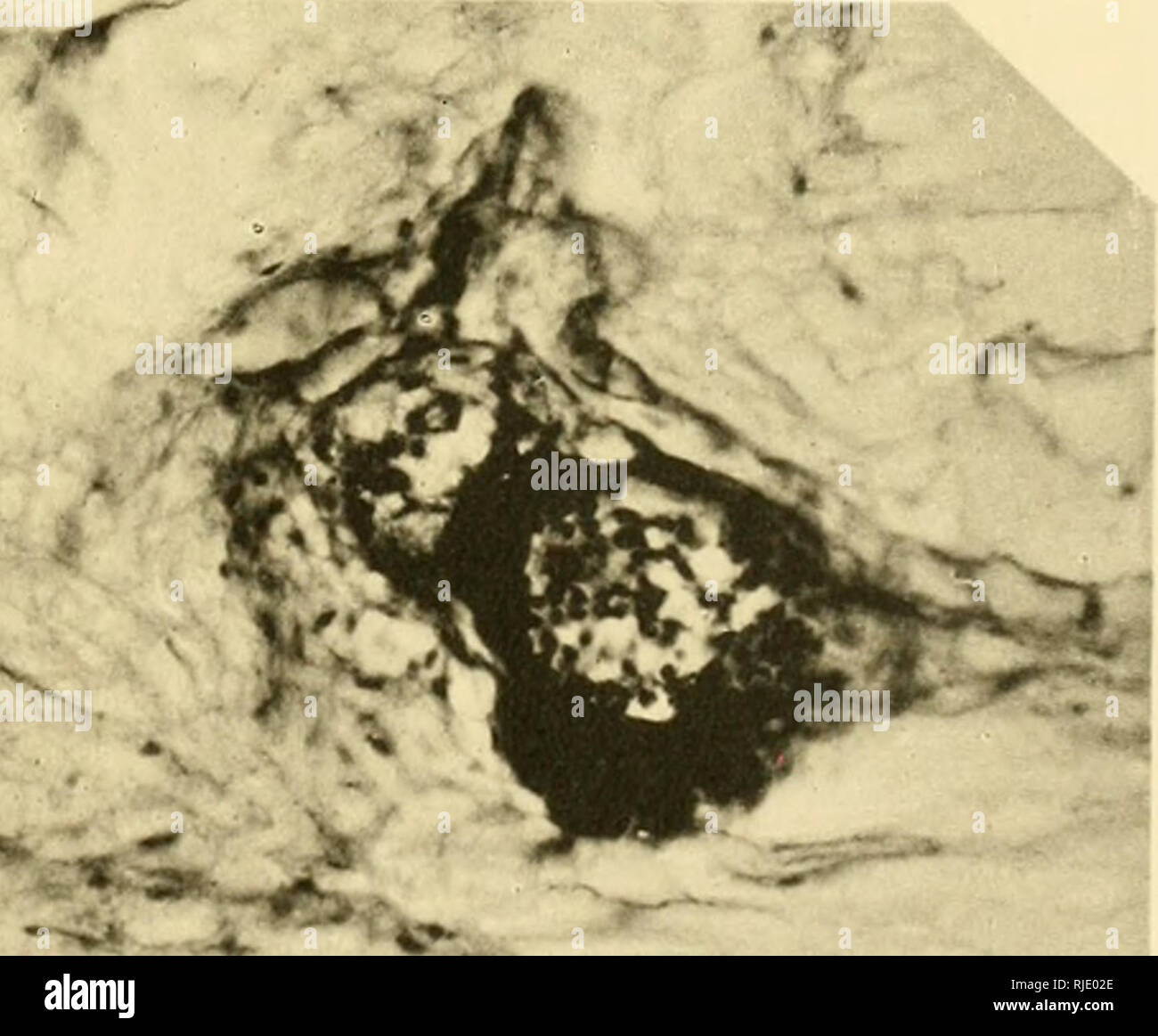 Left eye socket hi-res stock photography and images - Alamy