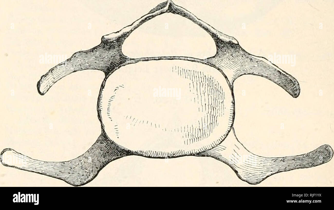 Wide central notch hi-res stock photography and images - Alamy