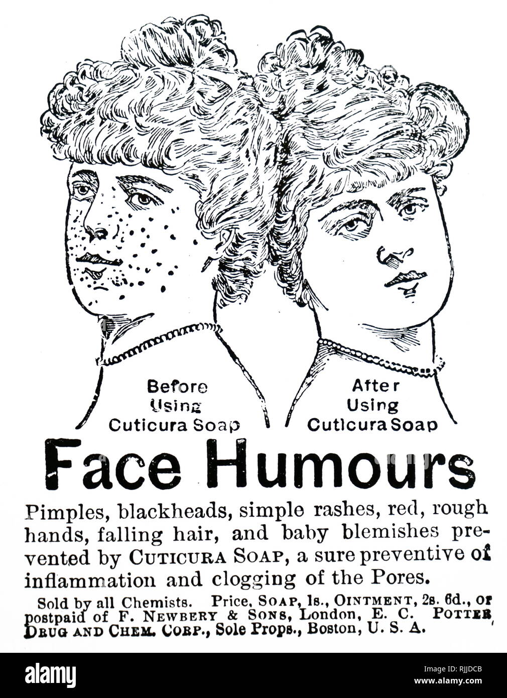 An advertisement for Cuticura soap, manufactured by the Potter Drug and ...