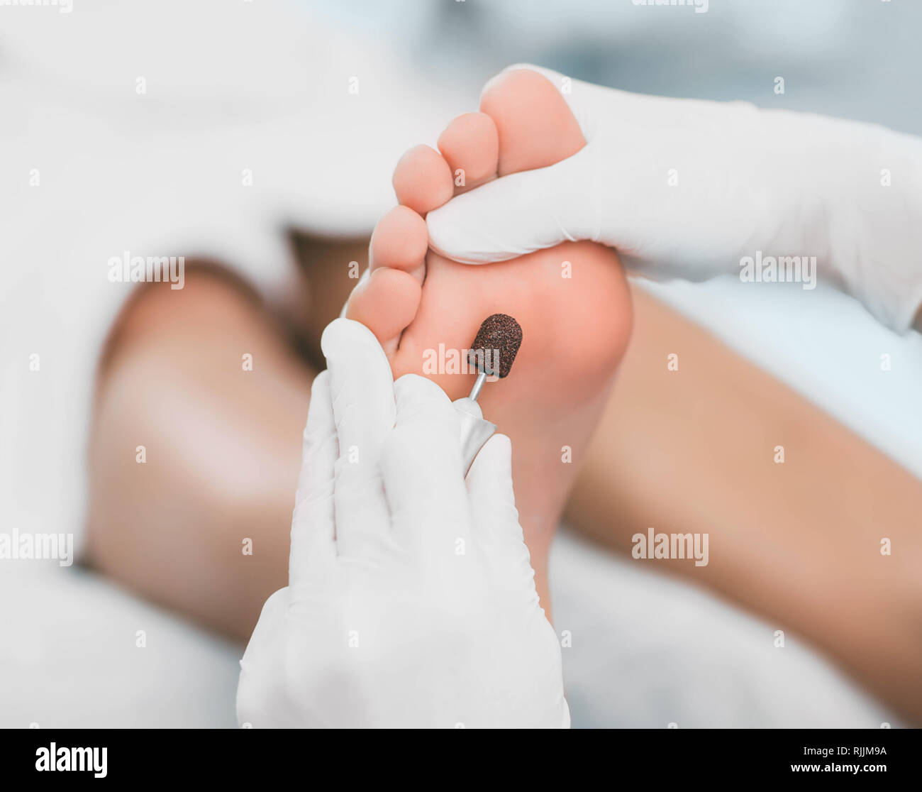 Chiropodist removes hardened skin on the foot, using hardware Stock ...
