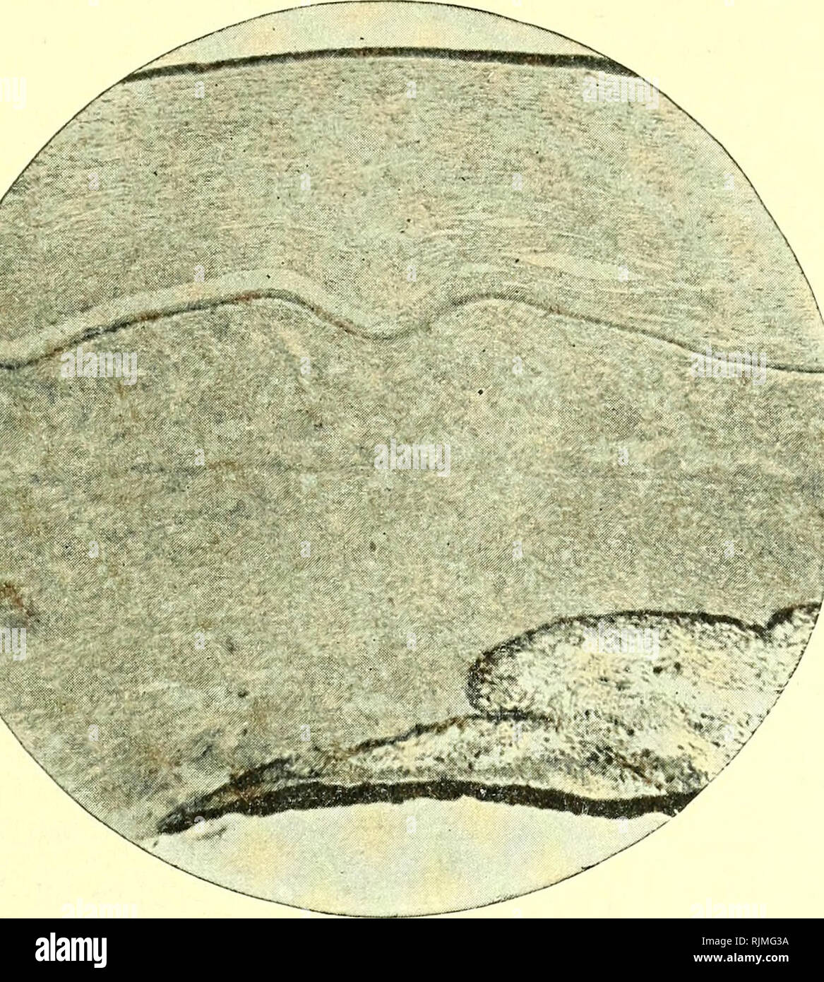 . Pathology and bacteriology [electronic resource]. Ophthalmology; Eye ...