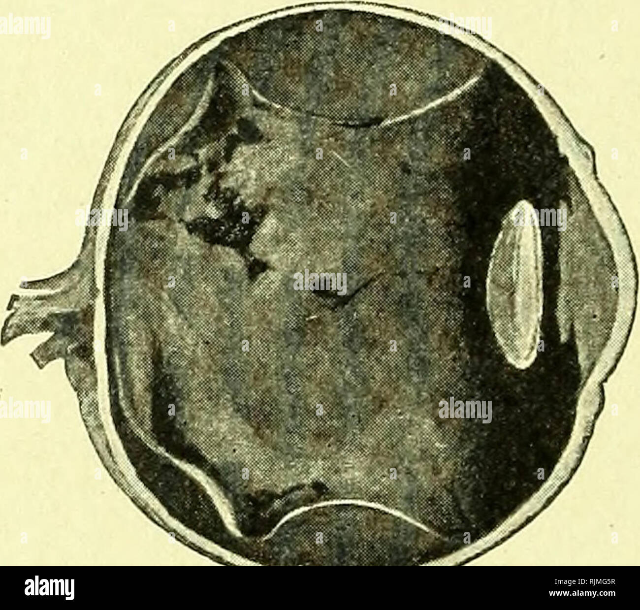 Layers of the retina hi-res stock photography and images - Alamy