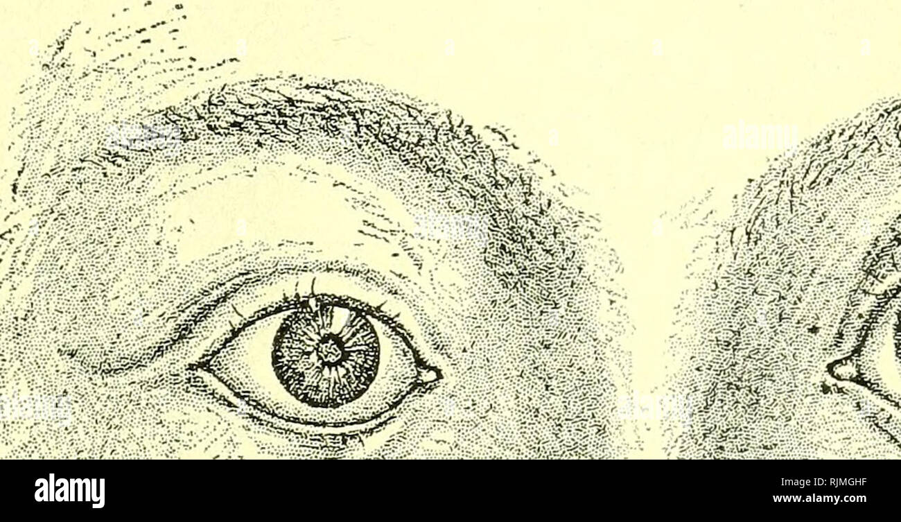 . Pathology and bacteriology [electronic resource]. Ophthalmology; Eye ...