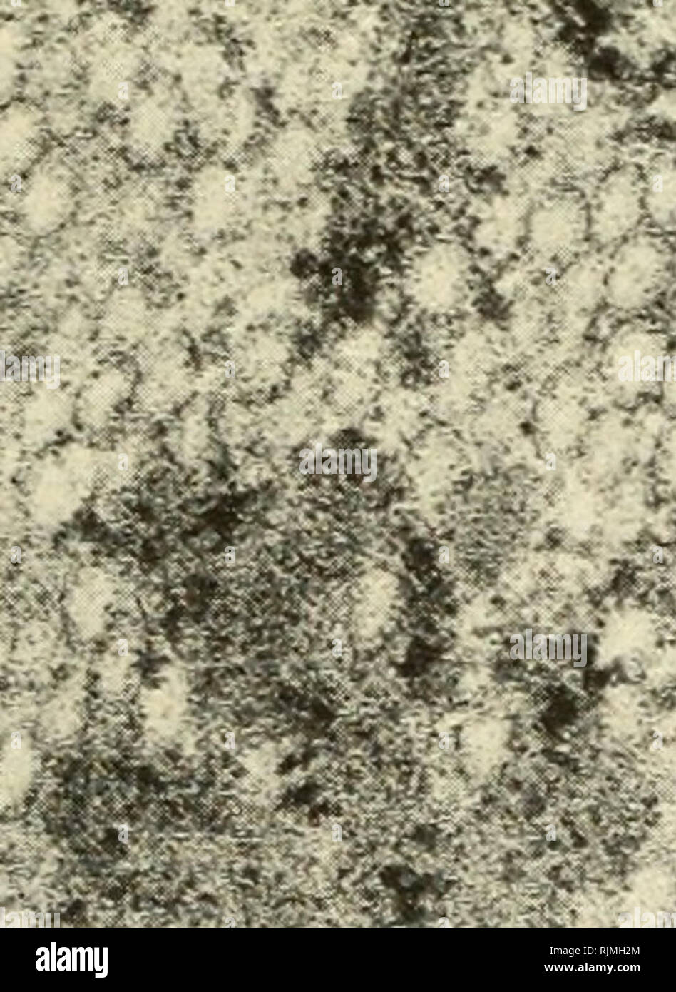 Bacterial slime layer hi-res stock photography and images - Alamy