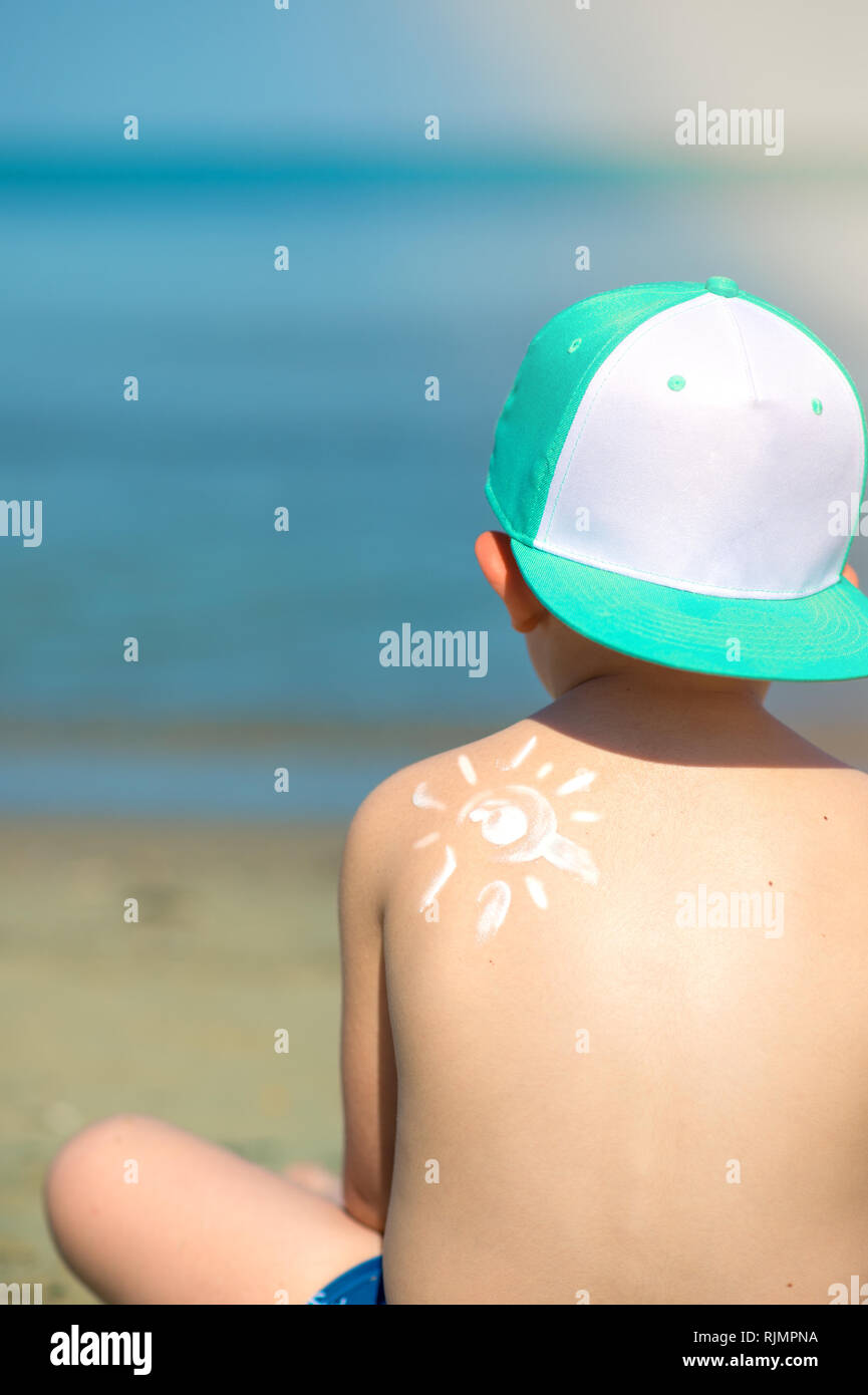 Sunburned skin child hi-res stock photography and images - Alamy