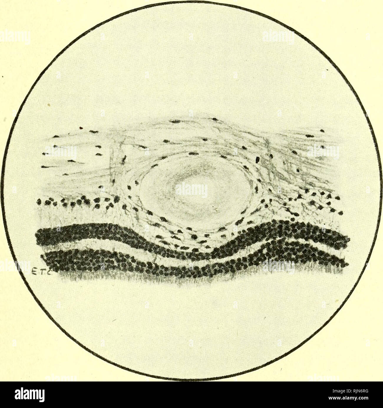 . Pathology and bacteriology [electronic resource]. Ophthalmology; Eye ...