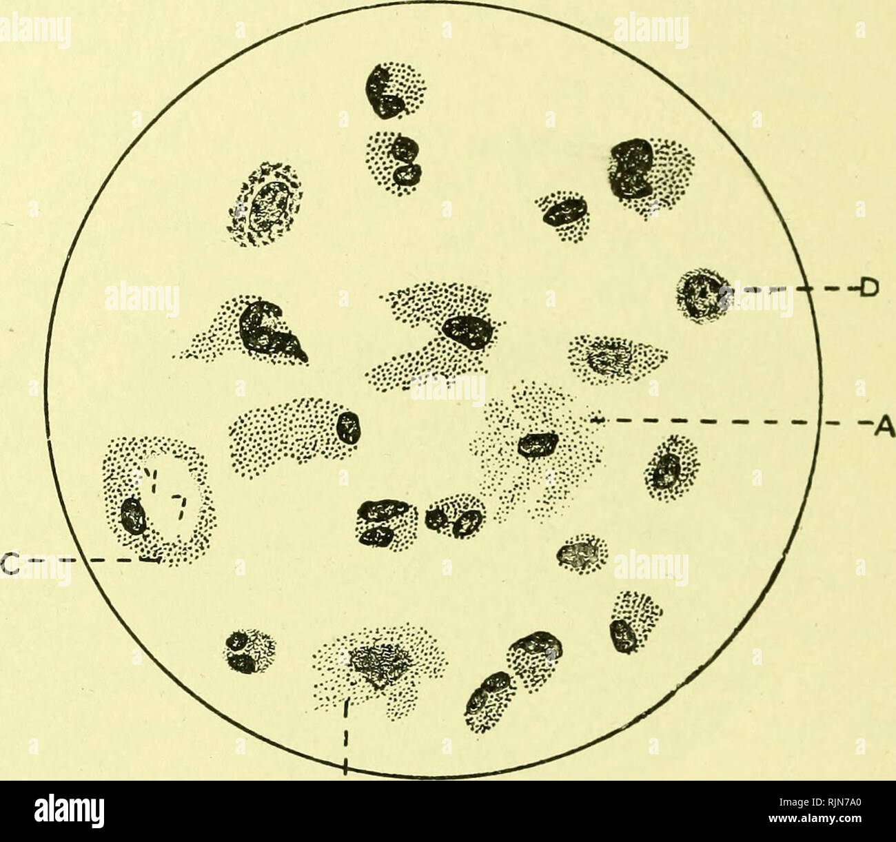 Mucoid eye discharge hi-res stock photography and images - Alamy