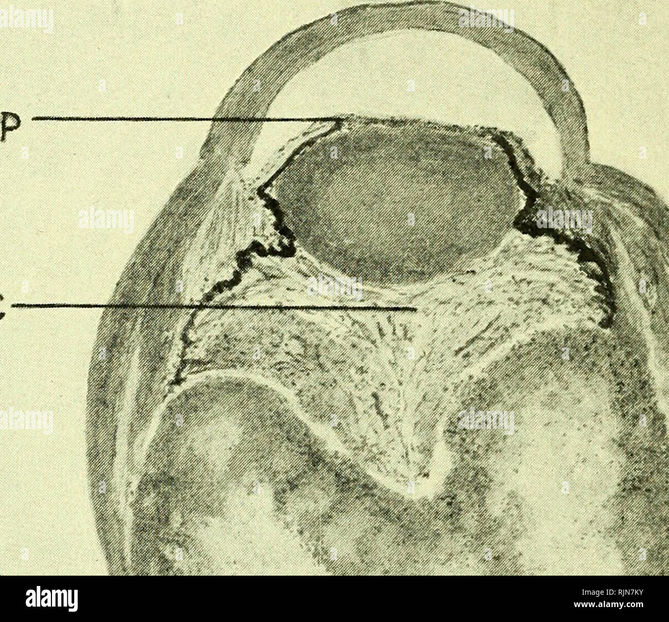. Pathology and bacteriology [electronic resource]. Ophthalmology; Eye ...