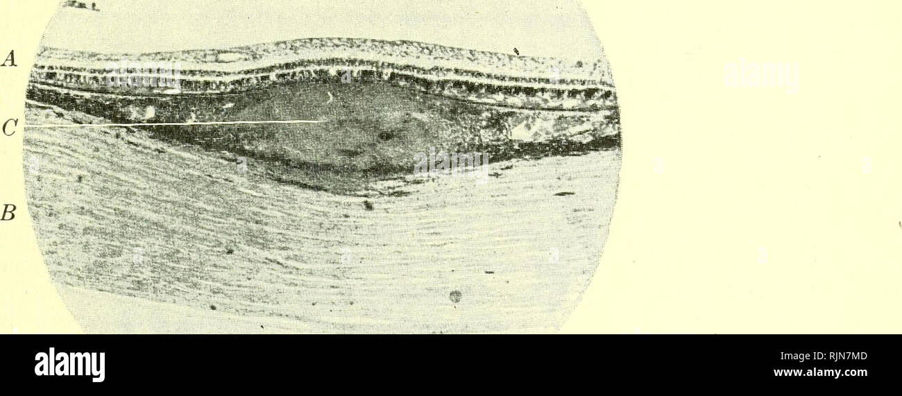 . Pathology and bacteriology [electronic resource]. Ophthalmology; Eye ...