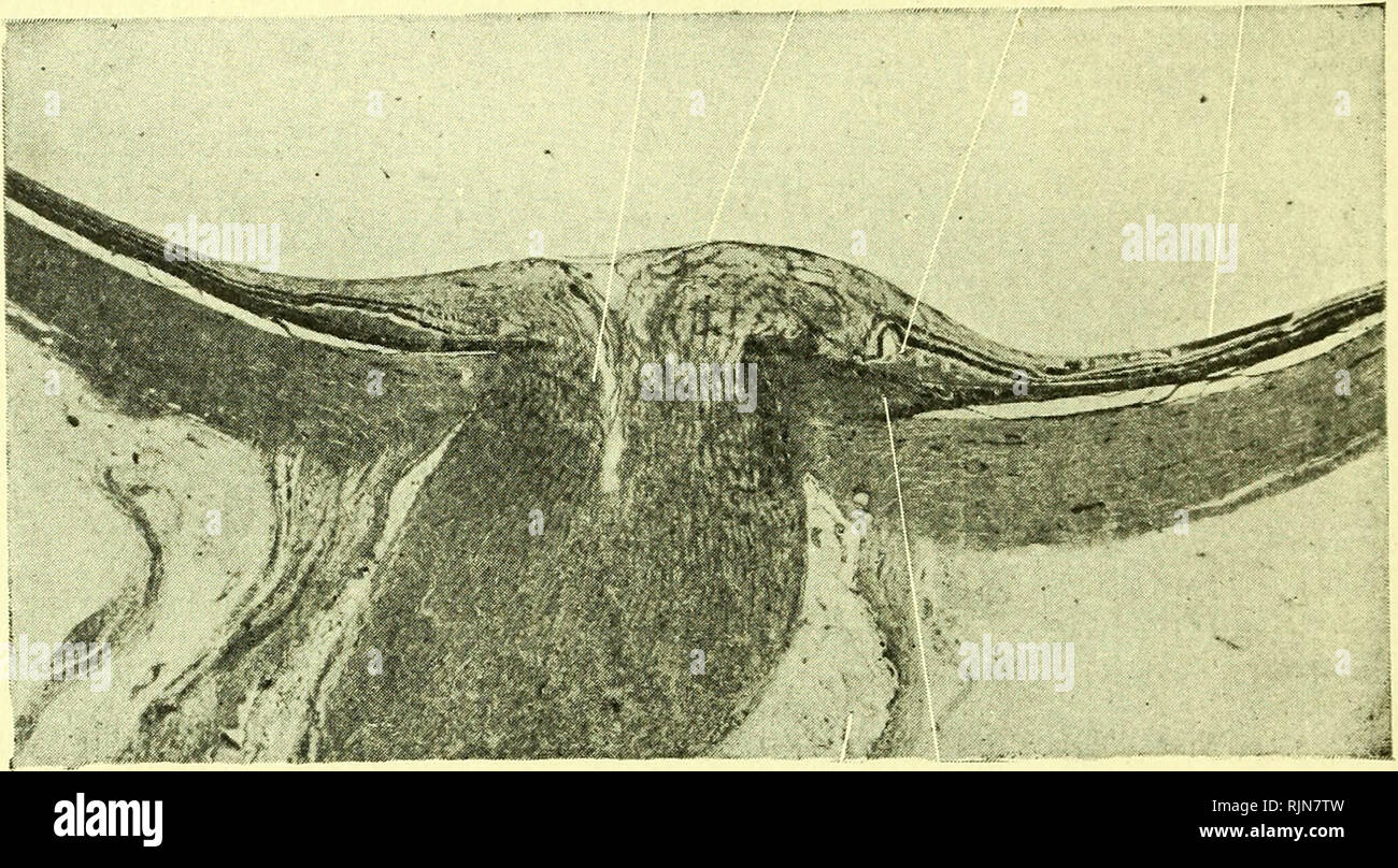 Membrane over eye hi-res stock photography and images - Alamy