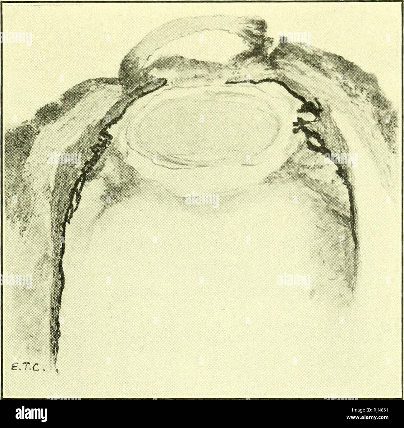 . Pathology and bacteriology [electronic resource]. Ophthalmology; Eye ...