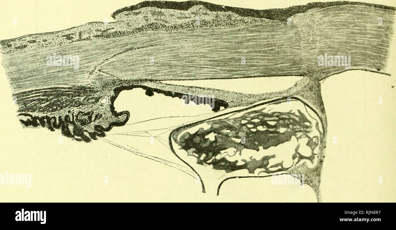 . Pathology and bacteriology [electronic resource]. Ophthalmology; Eye ...