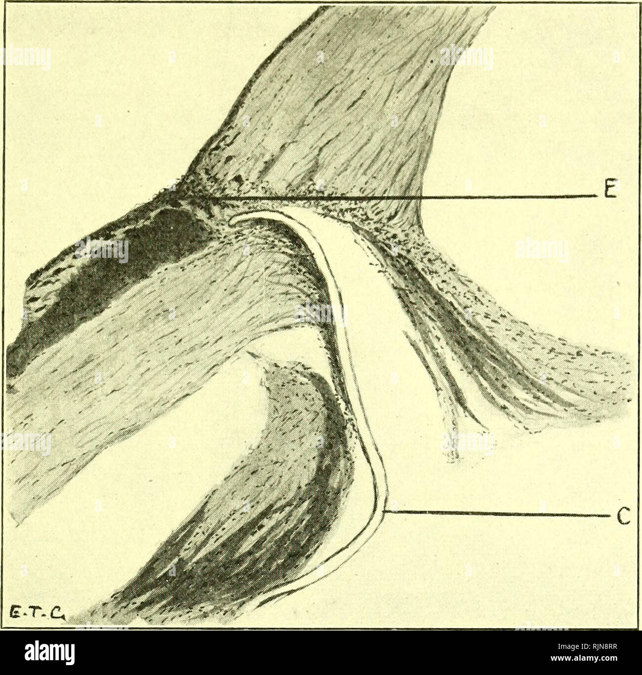 Corneal growth hi-res stock photography and images - Alamy