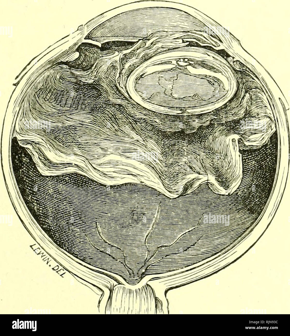 . Pathology and bacteriology [electronic resource]. Ophthalmology; Eye ...