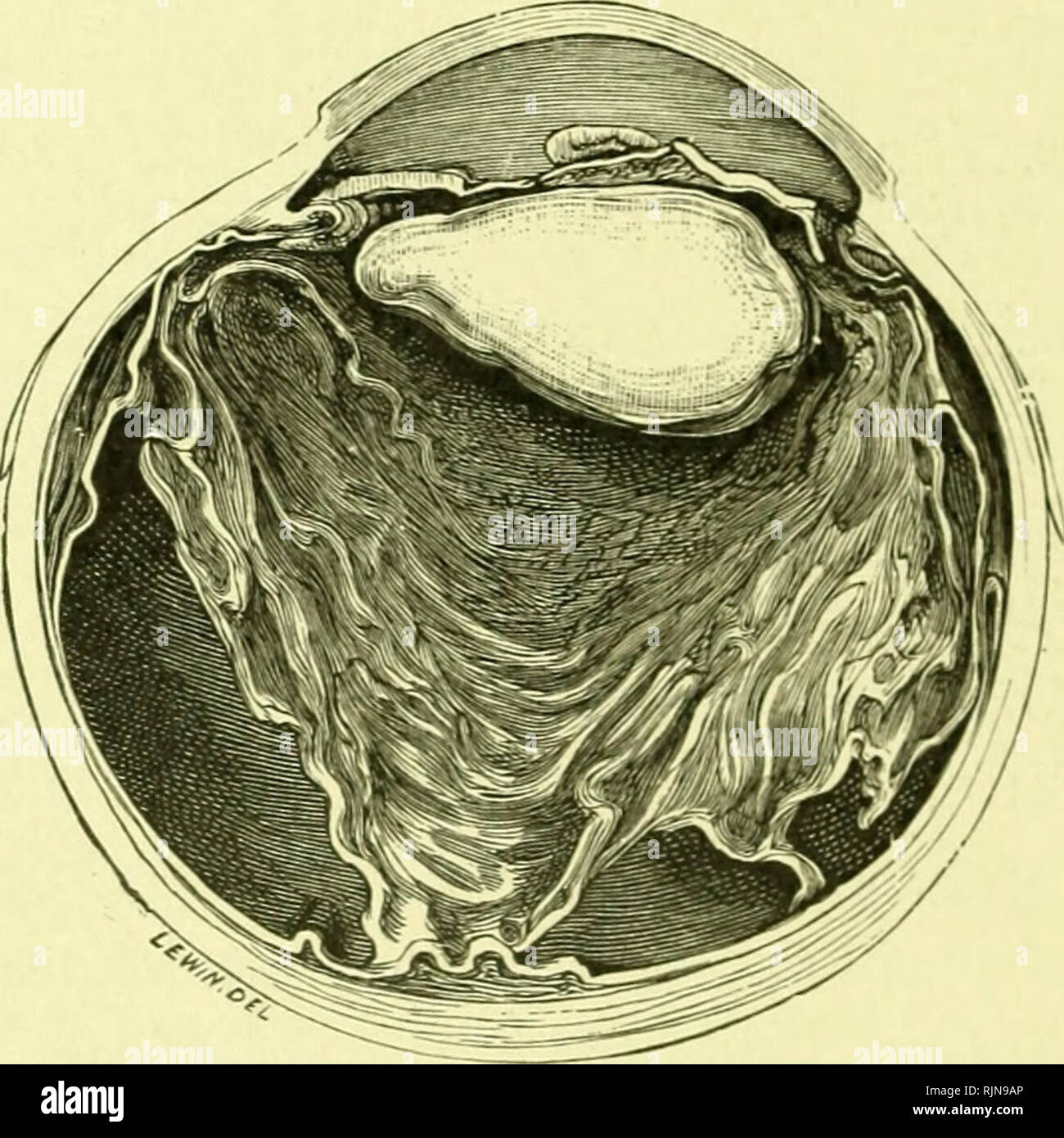 . Pathology and bacteriology [electronic resource]. Ophthalmology; Eye ...