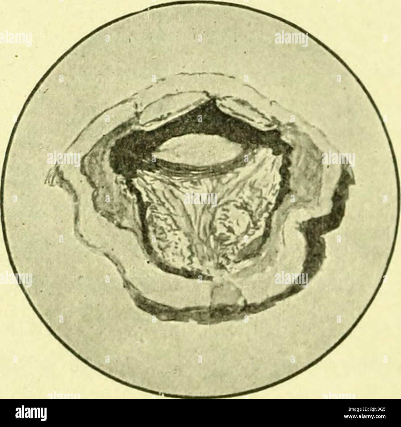 . Pathology and bacteriology [electronic resource]. Ophthalmology; Eye ...