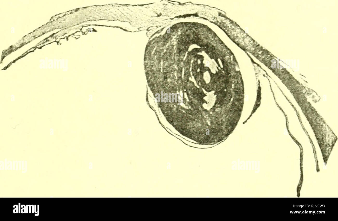 Occluded front hi-res stock photography and images - Alamy