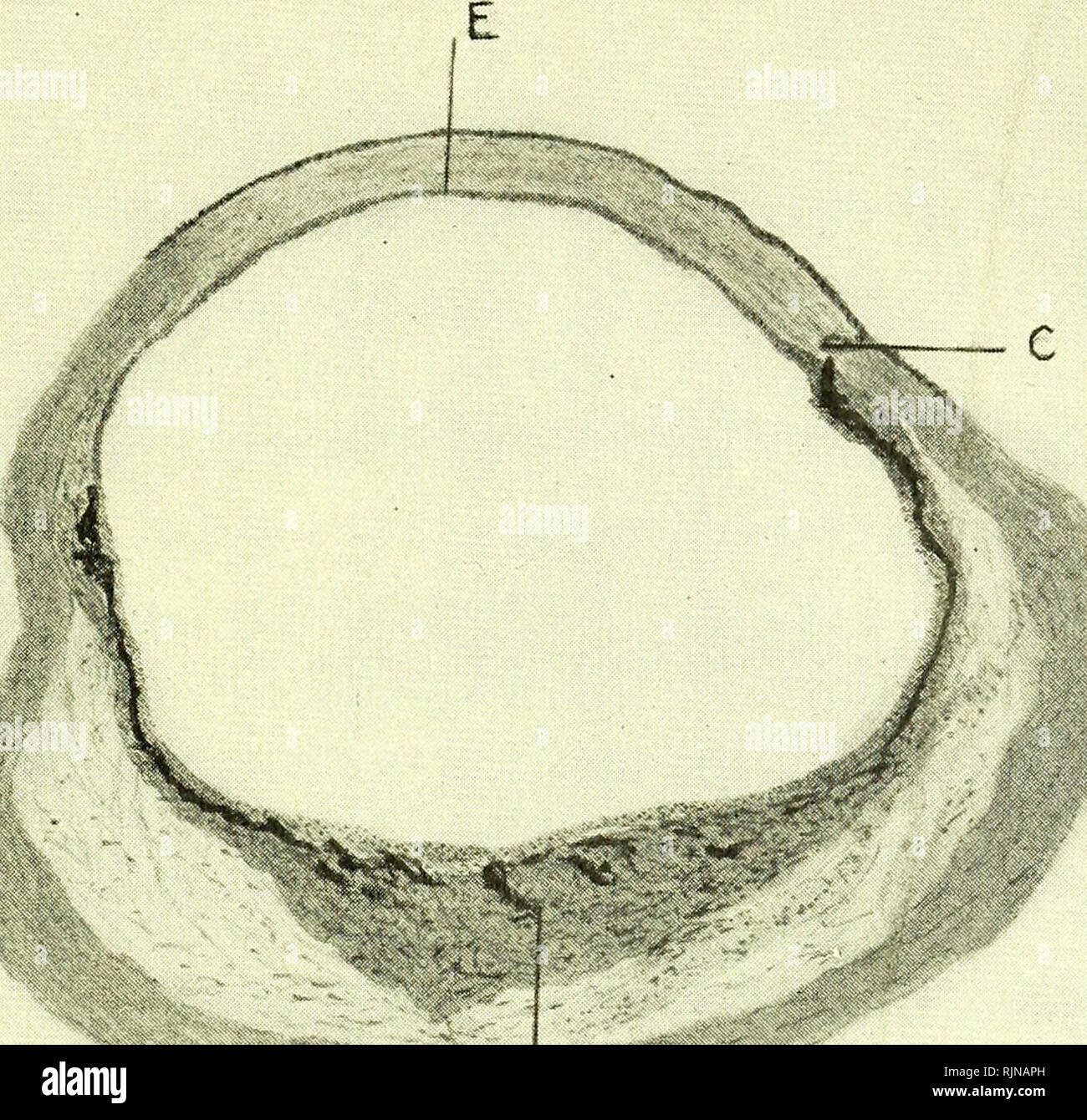 . Pathology and bacteriology [electronic resource]. Ophthalmology; Eye ...