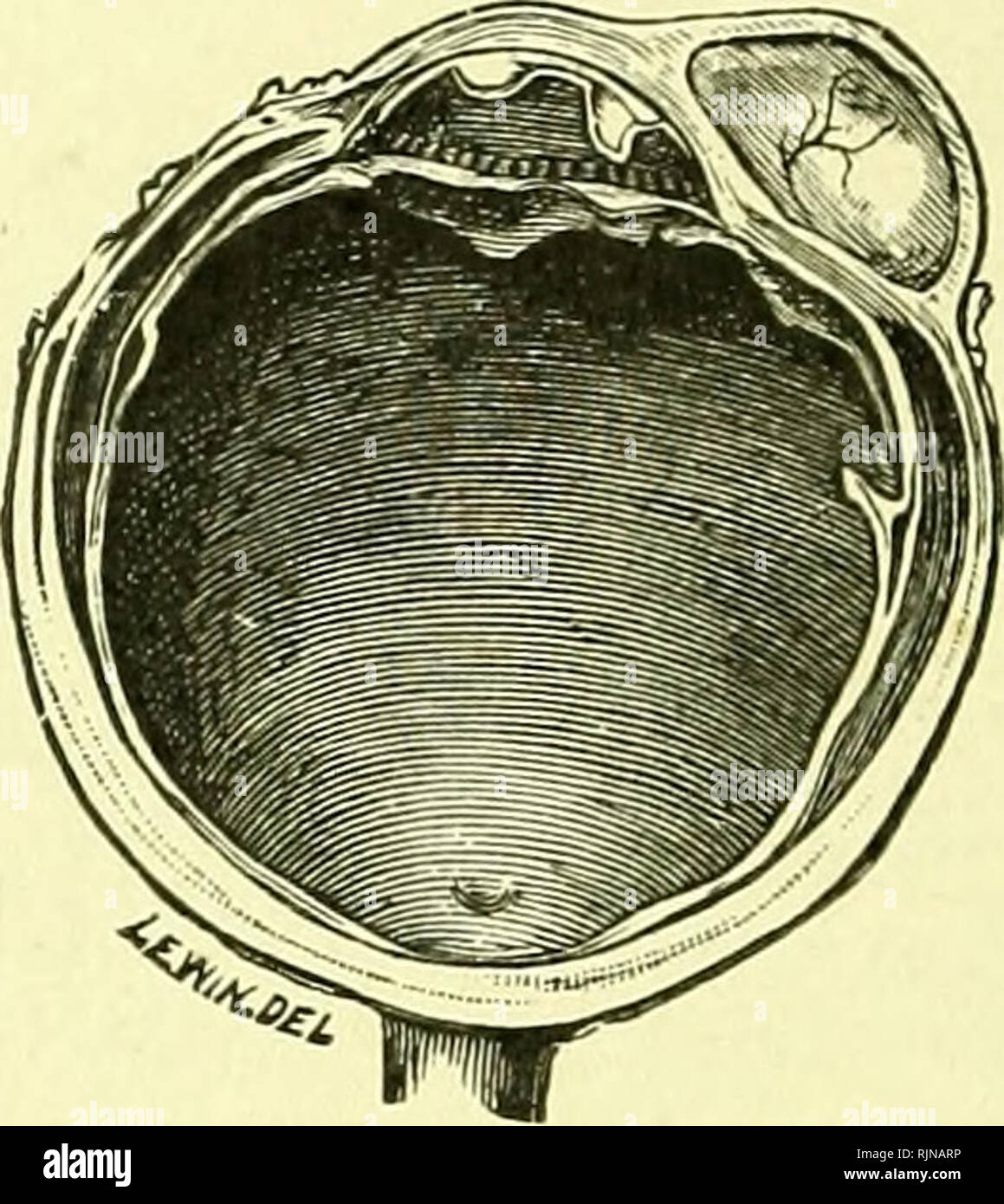 . Pathology and bacteriology [electronic resource]. Ophthalmology; Eye ...
