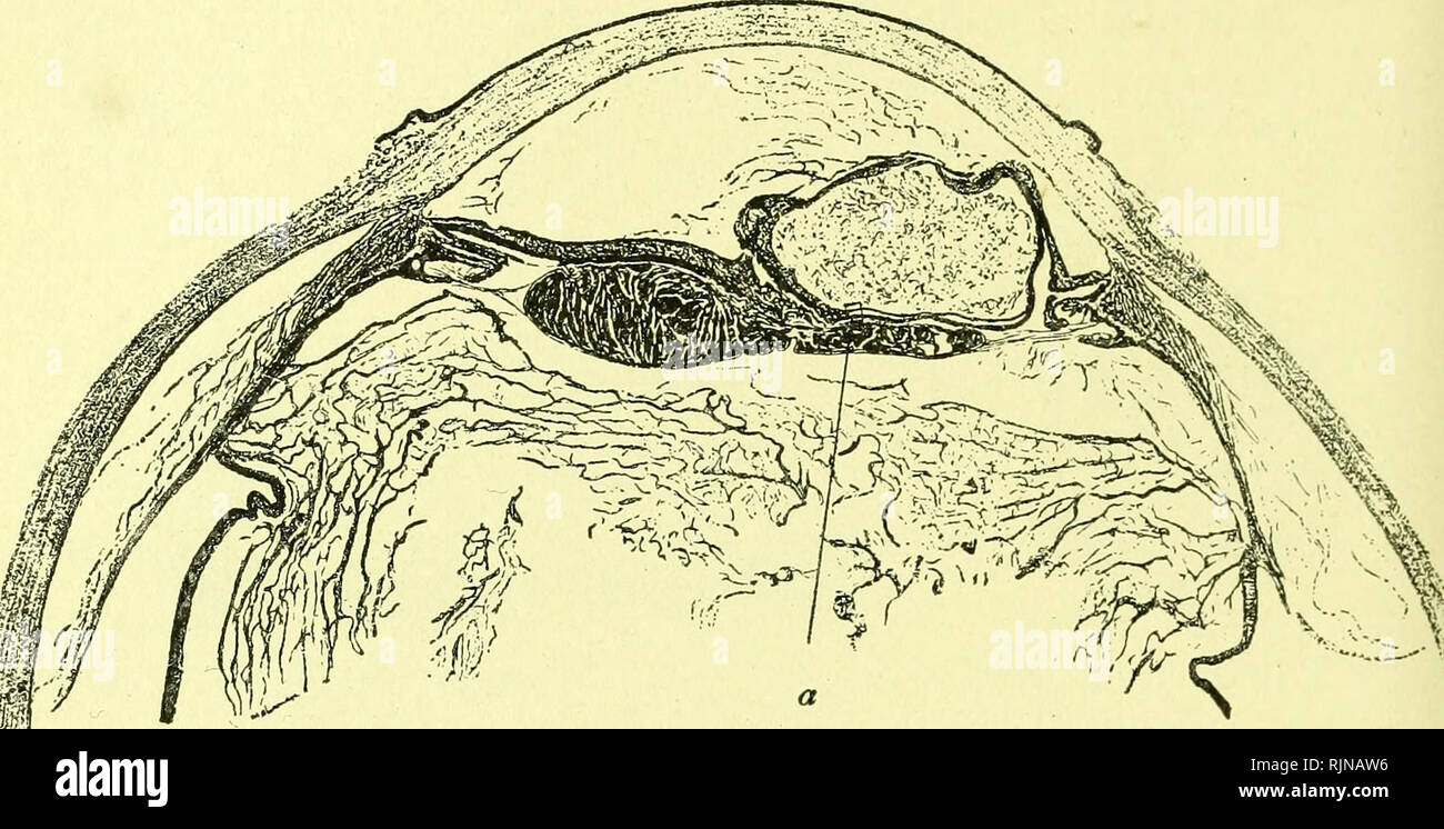 . Pathology and bacteriology [electronic resource]. Ophthalmology; Eye ...