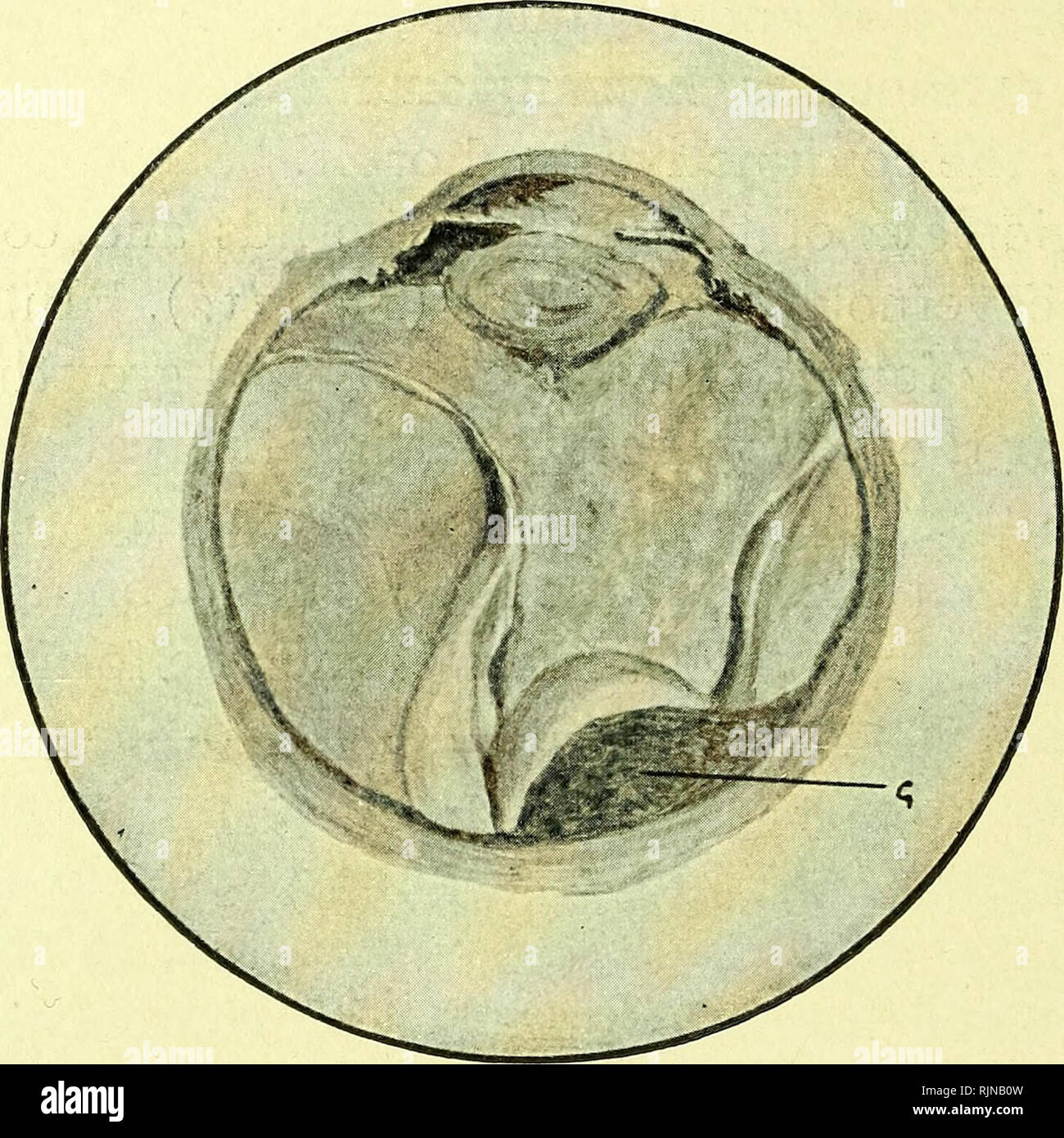 . Pathology and bacteriology [electronic resource]. Ophthalmology; Eye ...