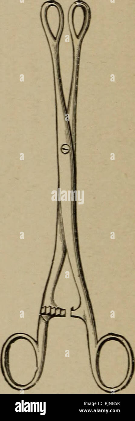 Uterine dilator hi-res stock photography and images - Alamy