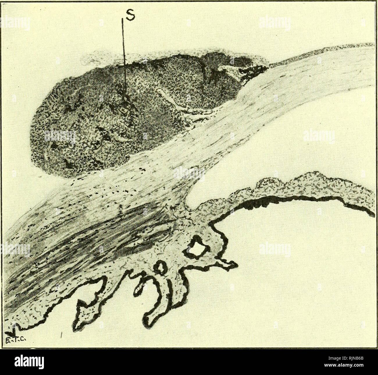 . Pathology and bacteriology [electronic resource]. Ophthalmology; Eye ...