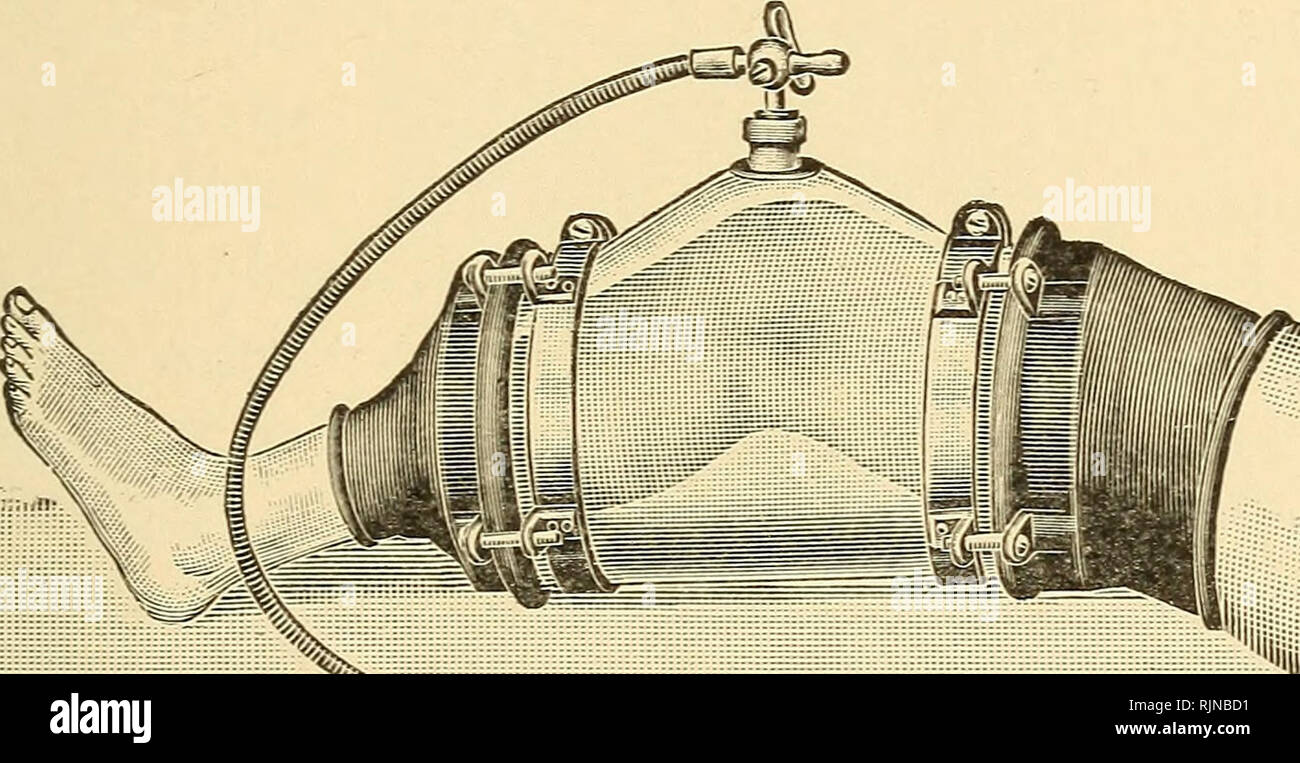 Proud flesh hi-res stock photography and images - Alamy