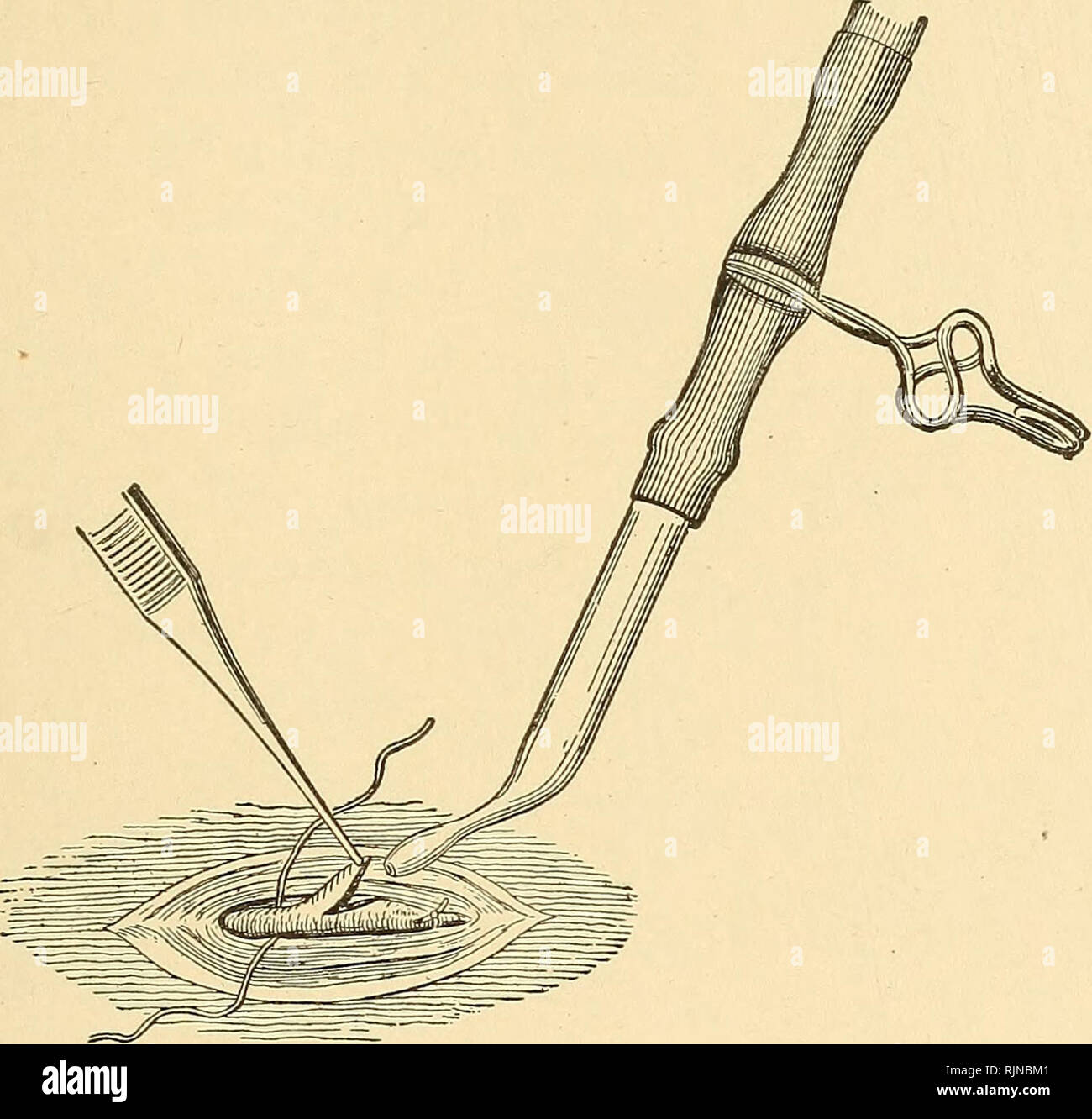 . Bacteriology and surgical technic for nurses. Nurses and nursing ...