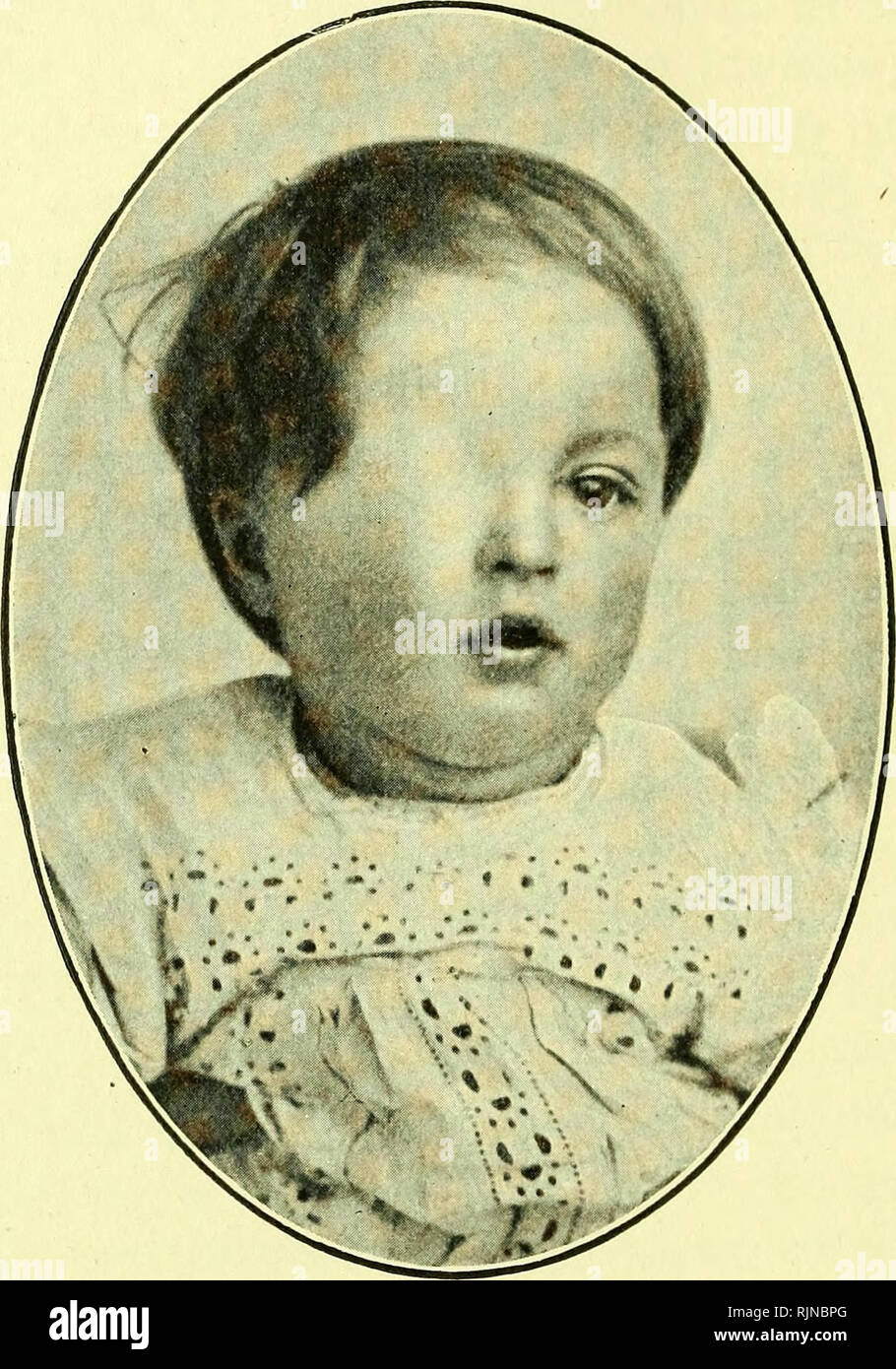 . Pathology and bacteriology [electronic resource]. Ophthalmology; Eye ...