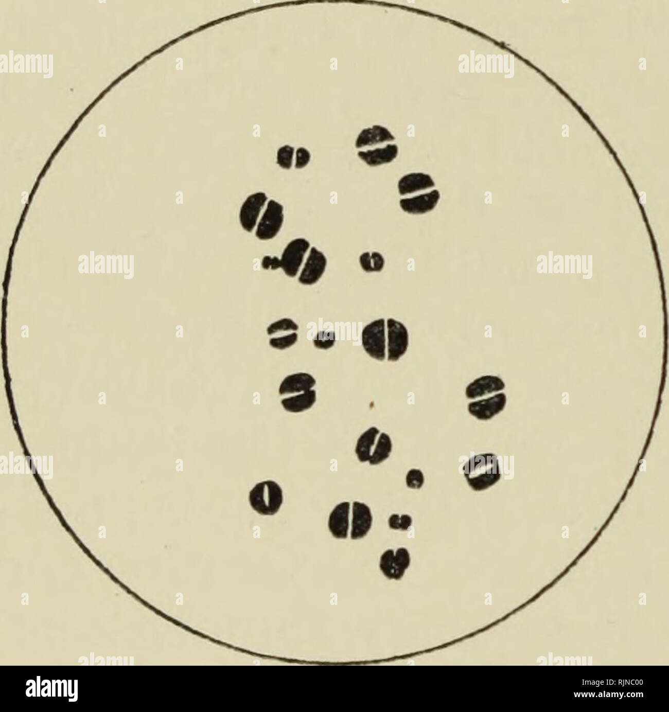 Bacteria septicaemia hi-res stock photography and images - Alamy