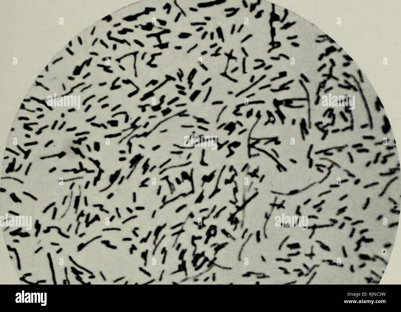 Bacillus typhosus hi-res stock photography and images - Alamy