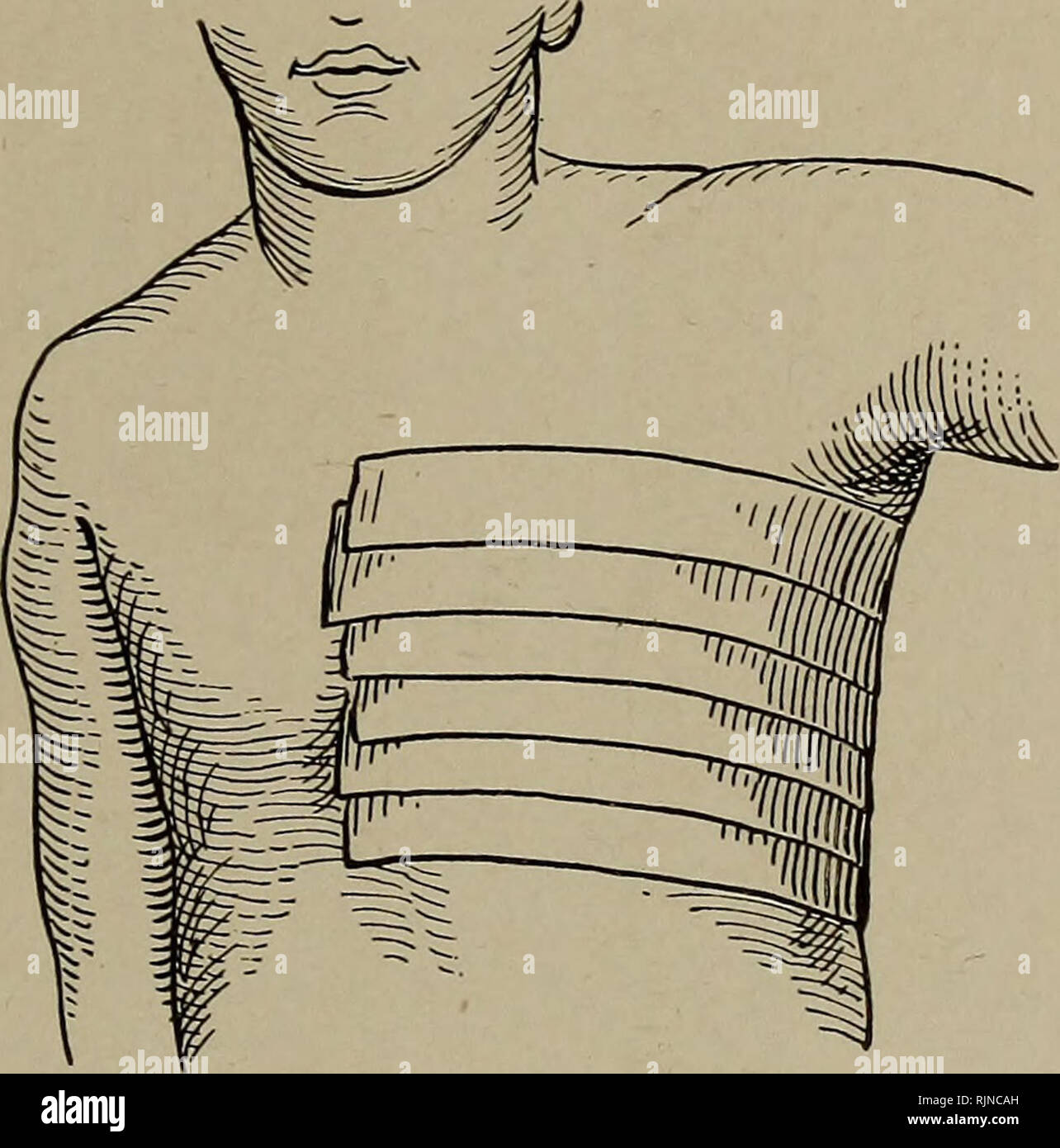 Strapping around hi-res stock photography and images - Alamy