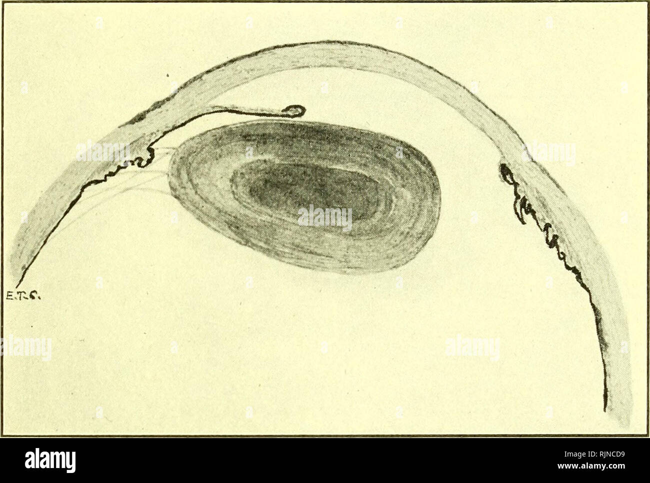 . Pathology and bacteriology [electronic resource]. Ophthalmology; Eye ...