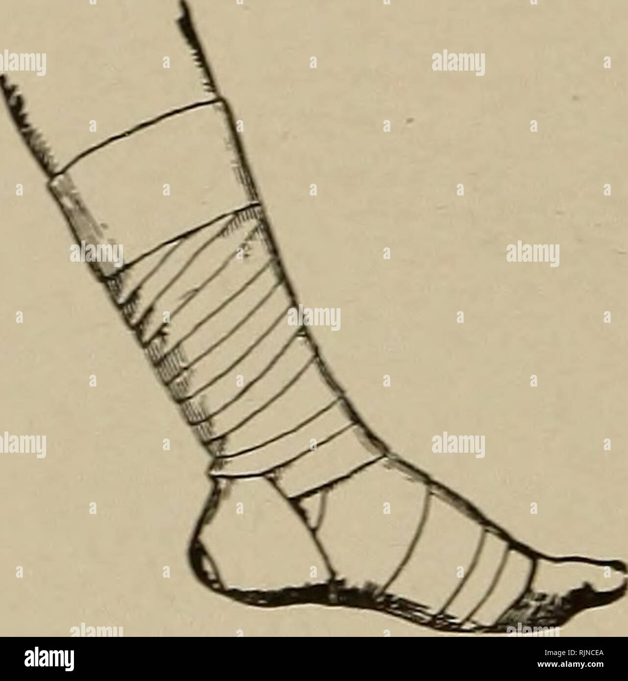 Spica Bandage High Resolution Stock Photography and Images - Alamy